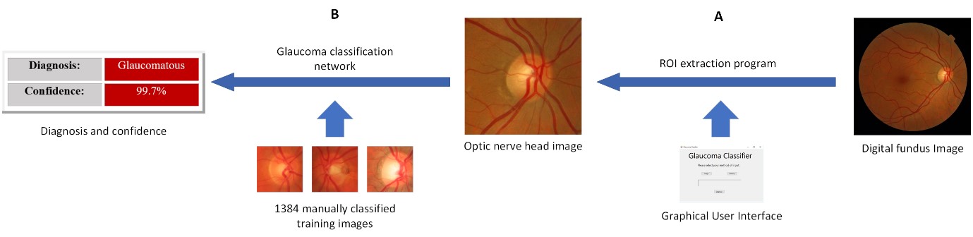 Glaucoma Classifier Neural Network On Fpga Diglab 8104
