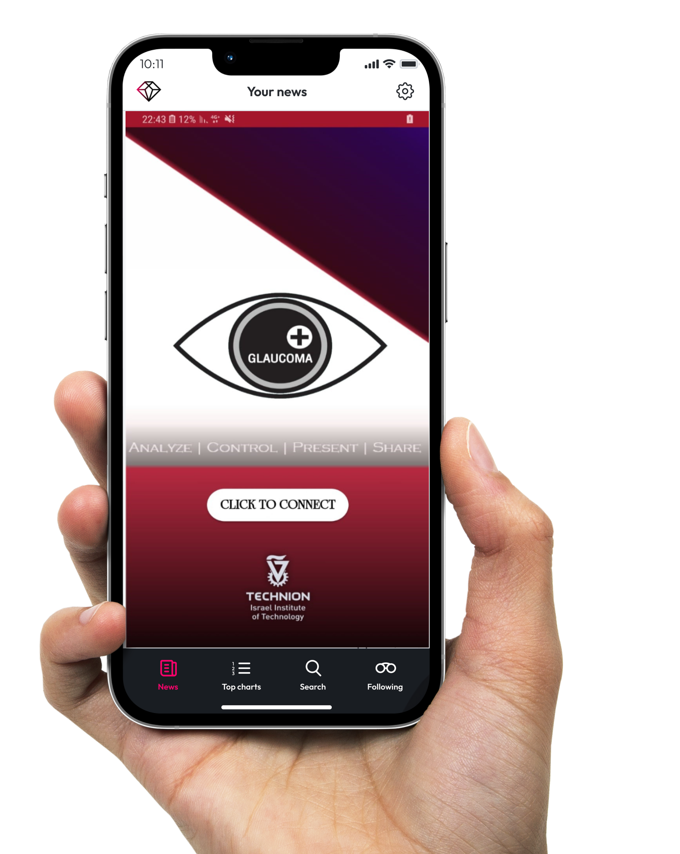 Glaucoma analysis system - Diglab